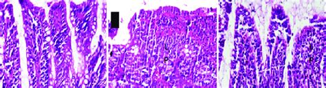 Goblet Cell Count Pmn Infiltration In Lamina Propria And Epithelial