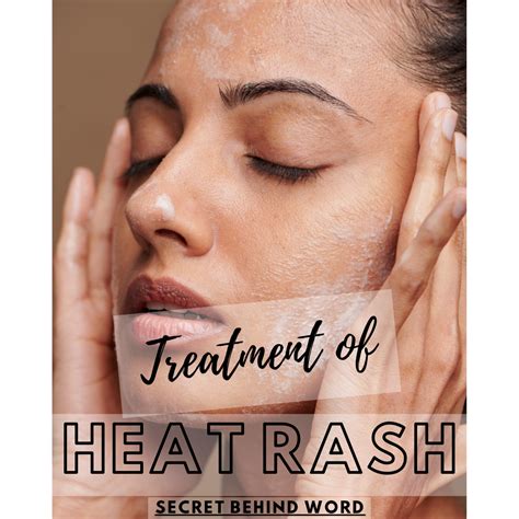How To Get Rid Of Heat Rash Quickly Home Remedies