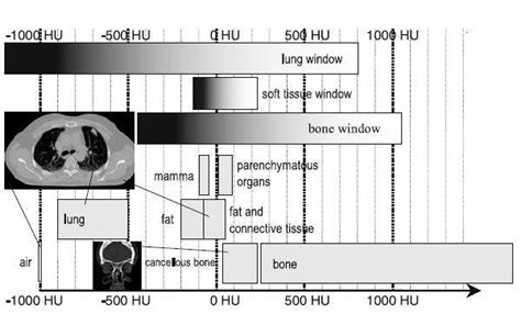 Hounsfield Units Scale For Various Tissues And Their Windows Modified
