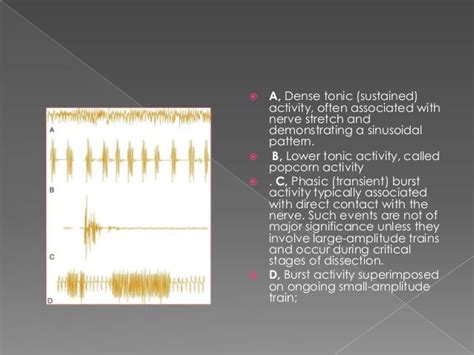 Intra Operative Monitoring Facial Nerve