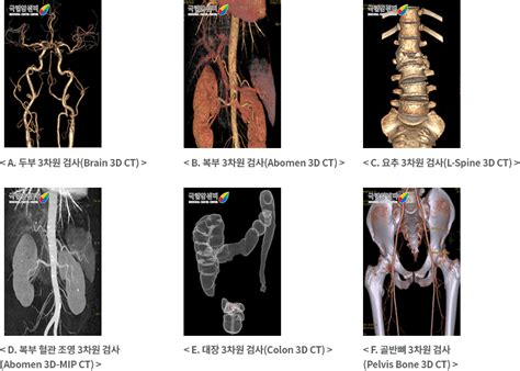 한국암환자권익협의회 Ct 검사