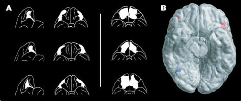 Reversal Learning And The Orbitofrontal Cortex Download Scientific Diagram