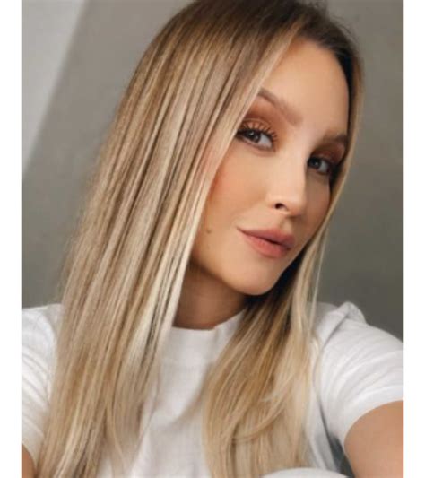 Foto Carla Diaz Tinha 29 Anos Quando Teve Câncer Purepeople