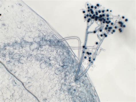 Hyaloperonospora Arabidopsidis Alchetron The Free Social Encyclopedia