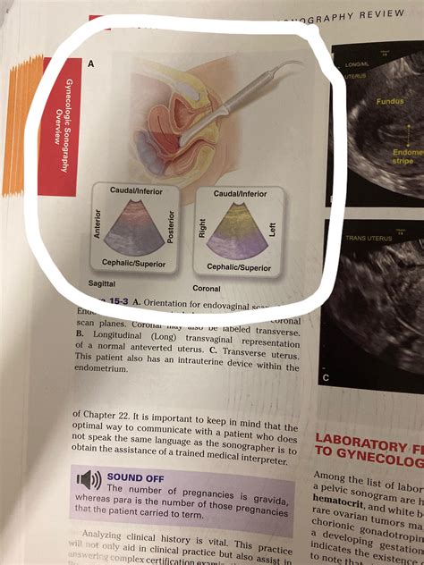 Tv Imaging Plane Help Rsonographers