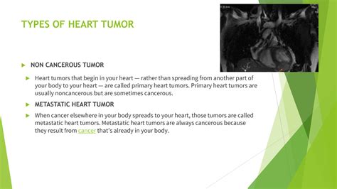 Solution Cardiac Sarcoma And Its Causes Symptoms And Treatment Studypool