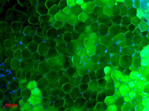 Potential Improvement In Type 2 Diabetes Treatment Discovered Monash