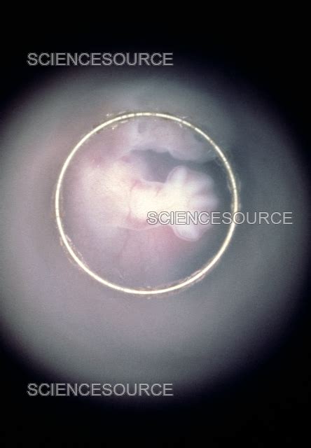 Human Embryo Hand Stock Image Science Source Images