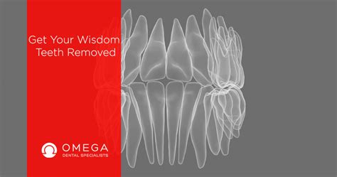 Wisdom Tooth Removal Before After Omega Dental Houston Tx
