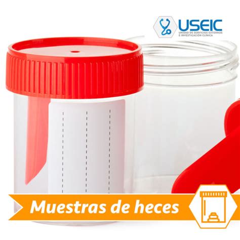 Sangre Oculta En Heces Useic