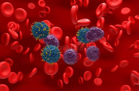 Hodgkin Lymphoma 3d Stock Illustrations 189 Hodgkin Lymphoma 3d Stock