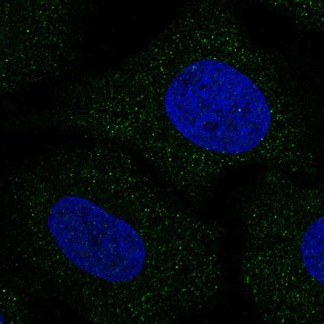 Rabbit Polyclonal Anti Slc30a8 Antibody Buy For Research Highly