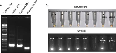 Dna Capture Assisted Rpa A Comparison Of Free Dna And Captured Dna By Download Scientific