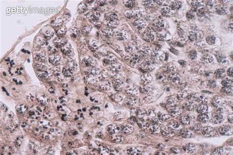 Education Of Grasshopper Testis Under The Microscope In Lab 1179973869 게티이미지뱅크