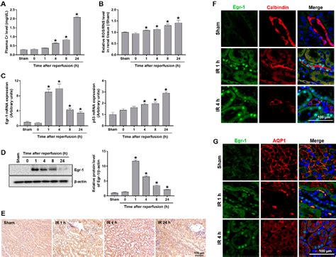 Figure 1 From Early Growth Response 1 Contributes To Renal Ir Injury By