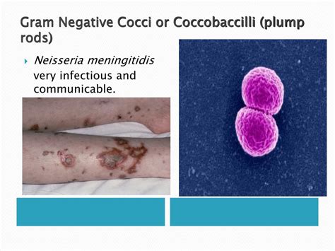 Ppt Classification Of Bacteria Powerpoint Presentation Free Download