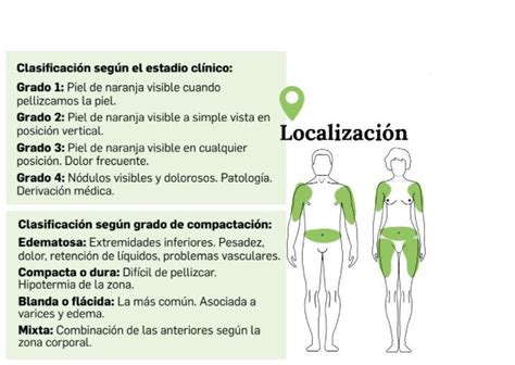 Que Es Celulitis Y Sus Causas más Estudiar