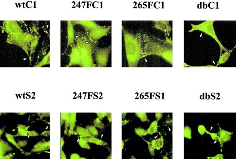 Localization Of Wt Or Mutant Cx43 To The Plasma Membrane Top Cells