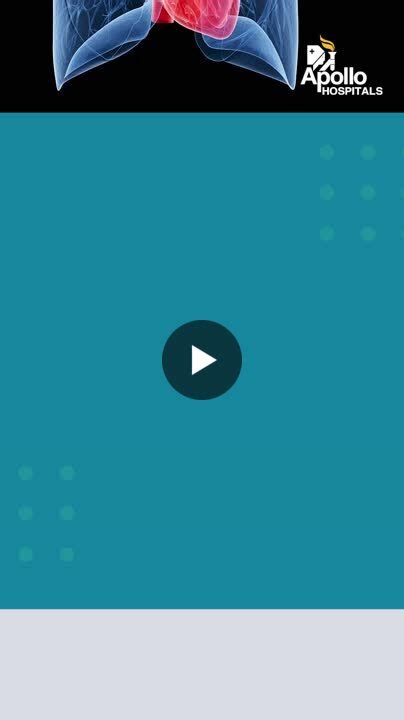 Ecmo Is Transforming Critical Care And Redefining Survival Of Severe