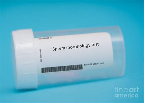 Sperm Morphology Test By Wladimir Bulgarscience Photo Library