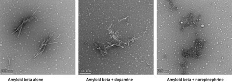 Transmission Electron Microscopy Amyloid Beta Alone And In The