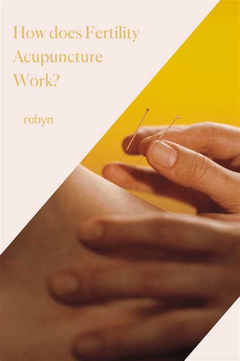 Discover The Benefits Of Fertility Acupuncture