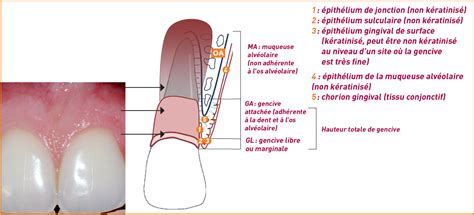 Anatomie Et Histologie De La Gencive Saine Figure 5