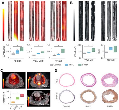 Frontiers Advanced Targeted Nanomedicines For Vulnerable Atherosclerosis Plaque Imaging And