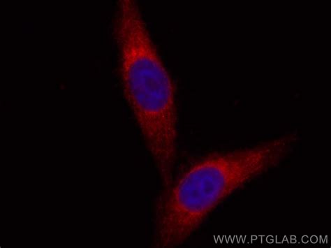 Plod3 Antibody Cl594 11027 Proteintech