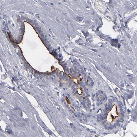 Anti TM4SF1 Antibody Produced In Rabbit