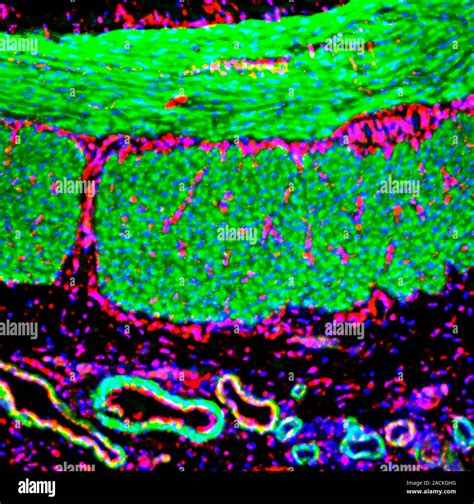 Gut Muscle Fluorescence Deconvolution Micrograph Of A Section Through Muscle Tissue From The
