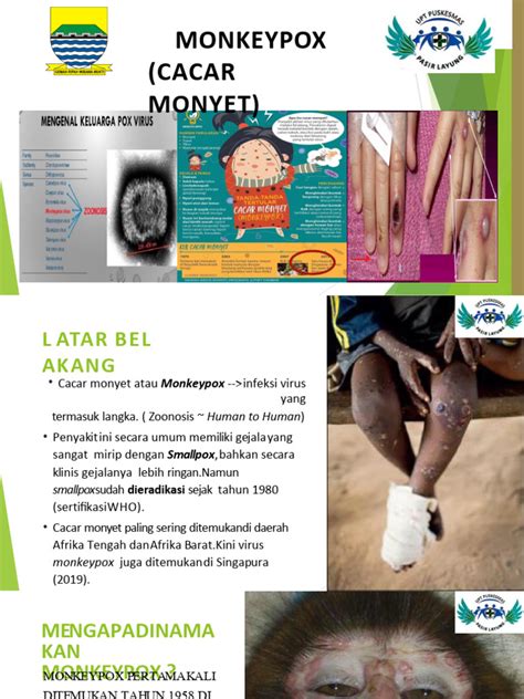 Diagnosis Dan Penanganan Monkeypox Virus Pdf