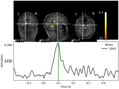 Compute Mne Inverse Solution On Evoked Data With A Mixed Source Space — Mne 1110 Documentation