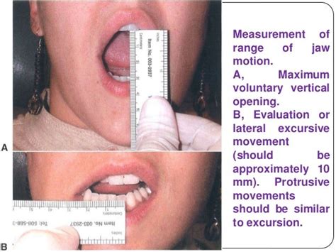 8 Temporomandibular Joint