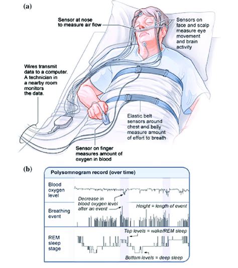 Malaysian Sleep Study What You Need To Know