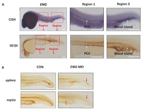 Whole Mount In Situ Hybridization In Zebrafish Embryos And Tube