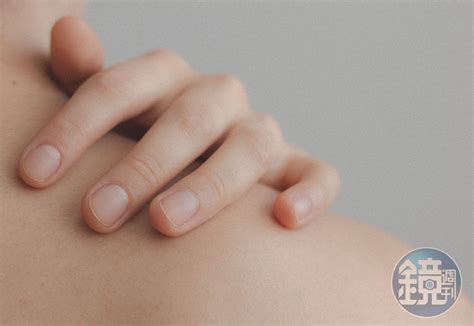澎湖爆發集體皮膚怪病元凶找到了 都是毛毛蟲剛毛惹的禍 鏡週刊 Mirror Media