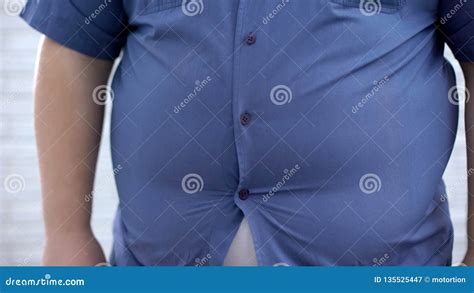 Fat Man Wearing Tight Blue Shirt Appearance Insecurities Hormonal