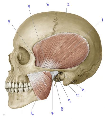 Fiszki Temporalis And Masseter Left Lateral View Superficial Layer