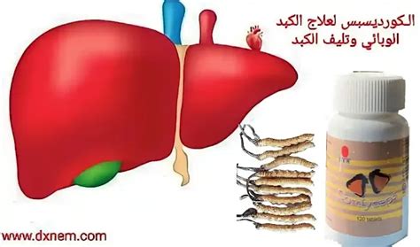 الـكورديسبس لعلاج الكبد الوبائي وتليف الكبد