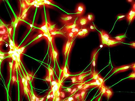 Neural Stem Cell Culture Photograph By Riccardo Cassiani Ingoniscience