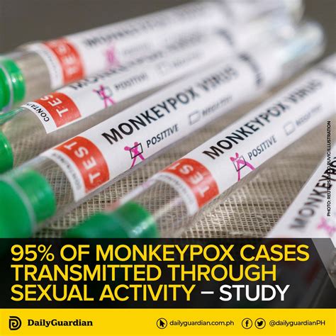 Daily Guardian On Twitter Ninety Five Percent Of Monkeypox Cases Have Been Transmitted Through