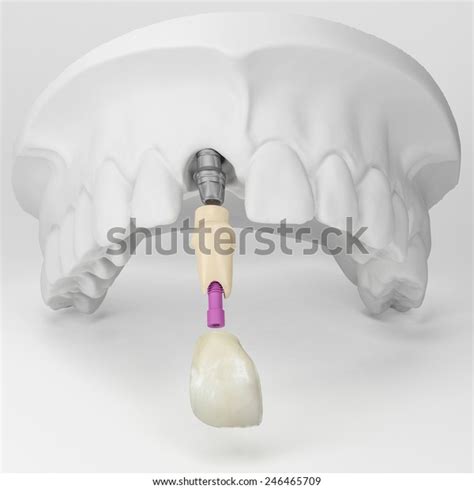 Teeth 3d Over 7 680 Royalty Free Licensable Stock Photos Shutterstock