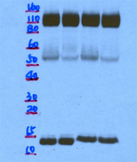 App Antibody Y188 Nb110 55461 Novus Biologicals