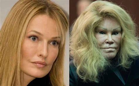 „catwoman Damals Und Heute So Sah Jocelyn Wildenstein Vor Ihrem