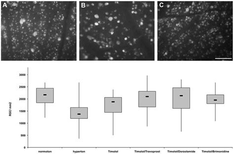 Densities Of Retinal Ganglion Cells Rgcs Labeled With 5 Fluorogold 8