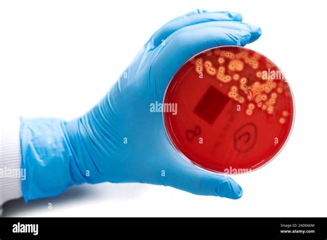 Cultured Streptococcus Bacteria Haemolytic Streptococcus Sp