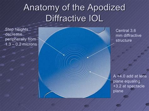Pre And Postoperative Care Of The Modern Cataract Patient