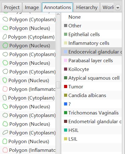 Annotations Classes Inconsistent With Projects Classes List Issue Qupath Qupath GitHub