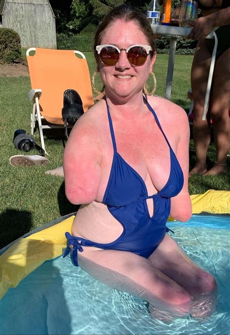 Sexy Quad Amputee Enjoying Her Pool Great Arm Stump Ive Got More Of Her Anyone Interested